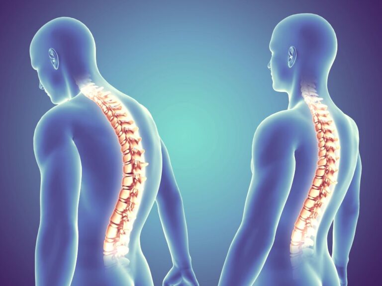 Dr. Larry Davidson: The Value of Team-Based Care for Chronic Spine ...